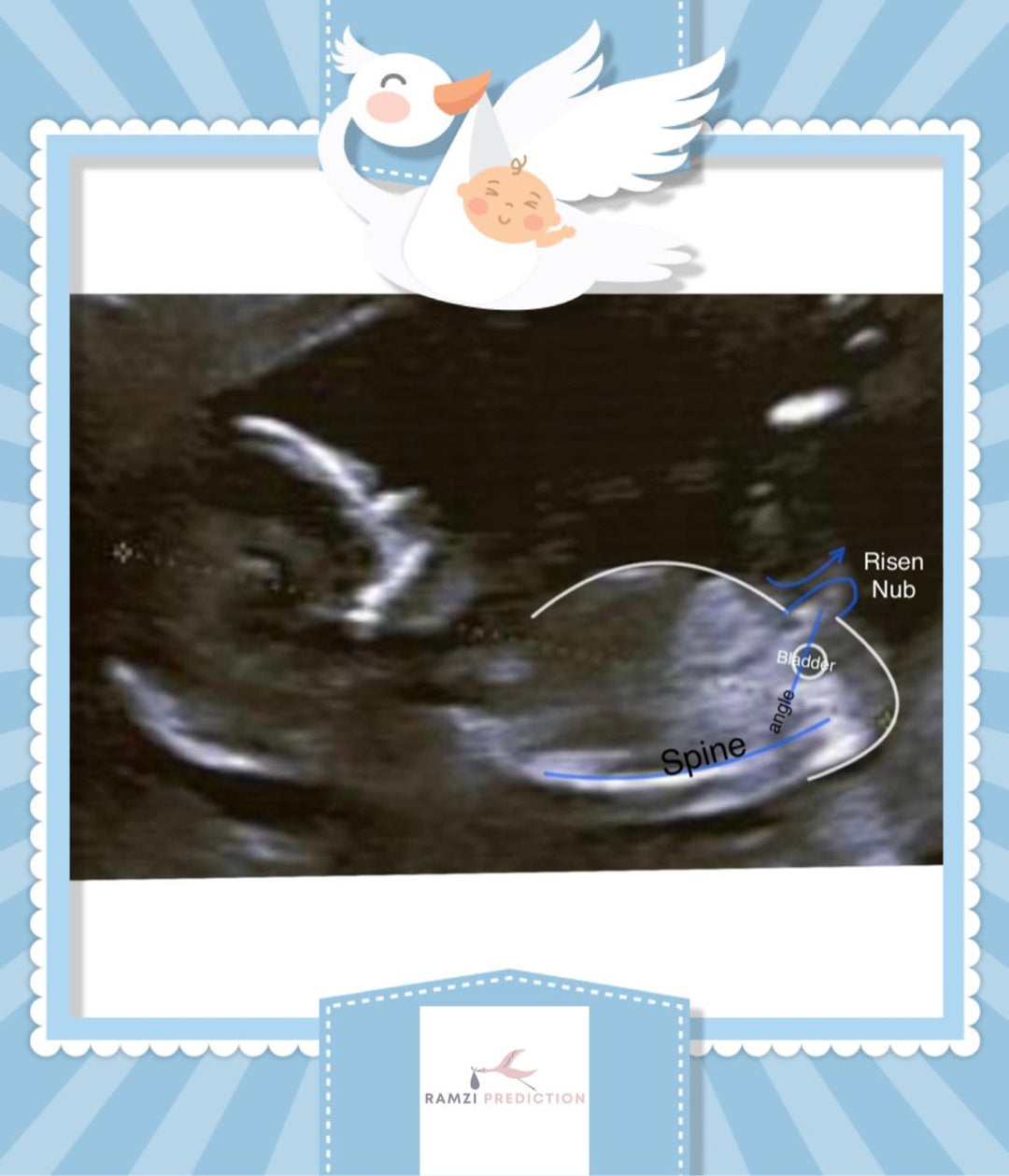 The Confirmed Scans | Early Pregnancy Gender Prediction Experts | Ramzi ...