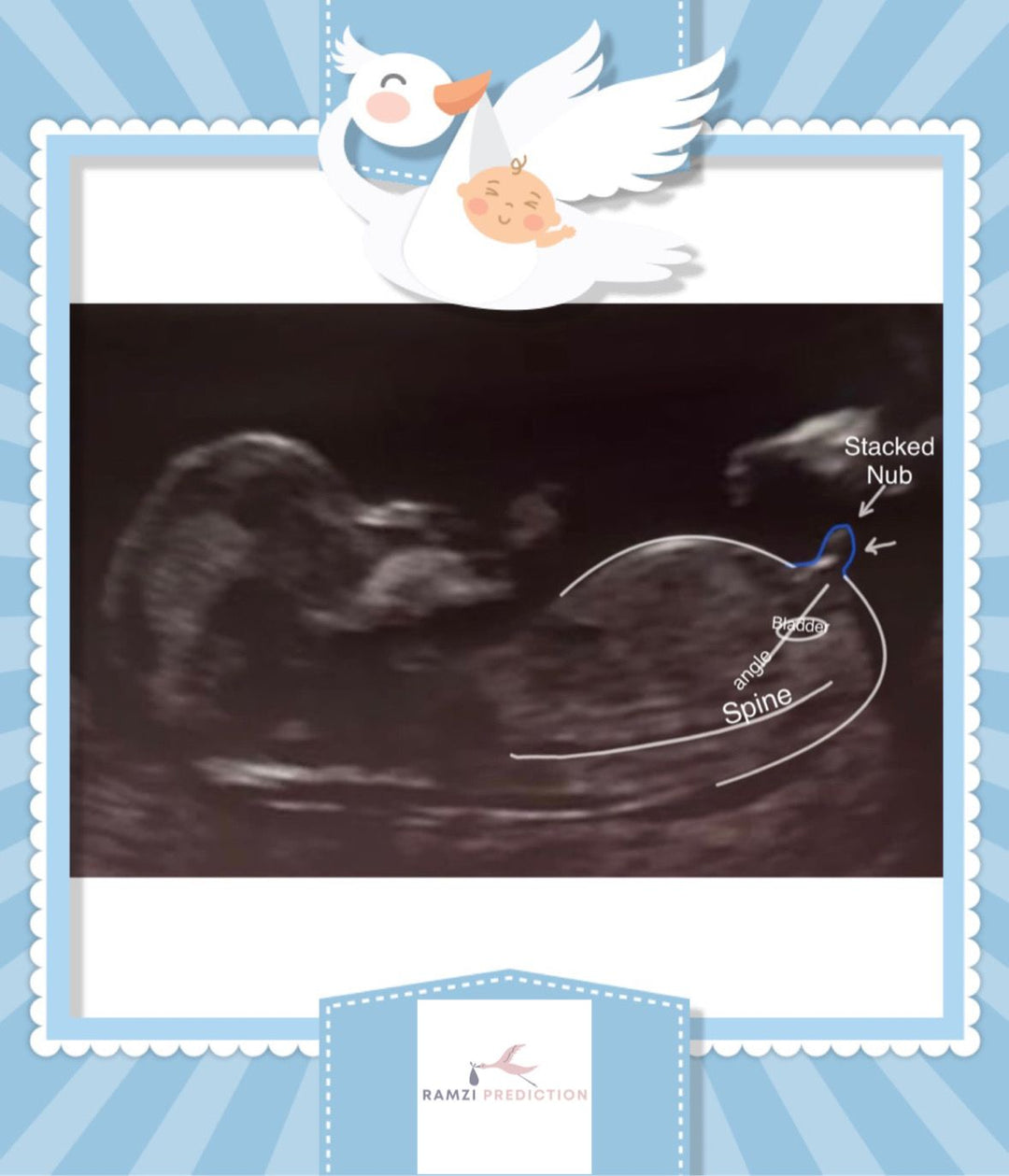 The Confirmed Scans | Early Pregnancy Gender Prediction Experts | Ramzi ...